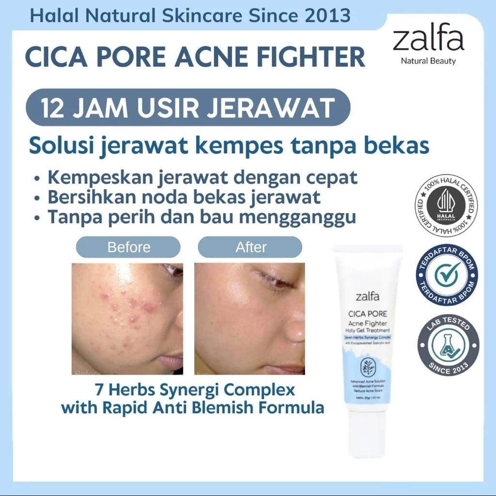 Jual ZALFA NATURAL - CICA PORE ACNE FIGHTER HOLY GEL TREATMENT | Shopee ...