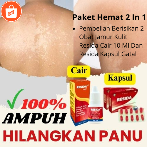 Jual Obat Kulit Panu Kudis Exim/ Resida Kapsul Obat Dalam Pembersih ...