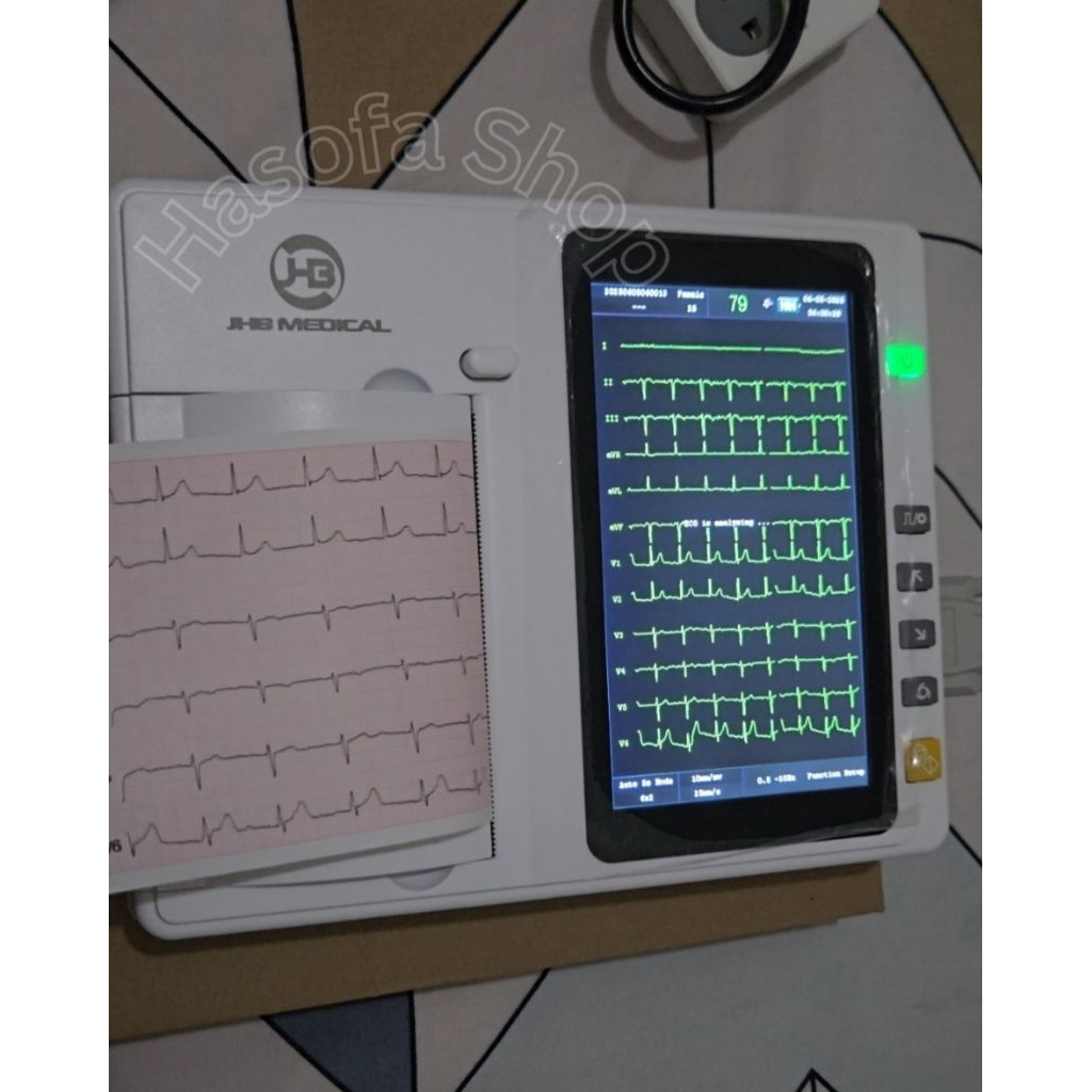 Jual ECG EKG 6 Channel Digital Electrocardiography JH-601A | Shopee ...