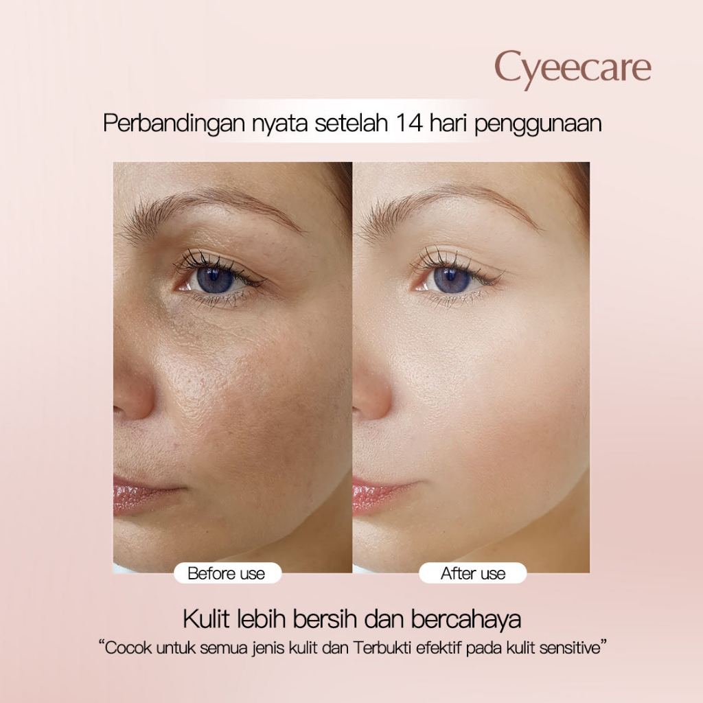 Jual Cyeecare Facial Foam 80ml + Peeling Solution Serum 20g + Tone-Up Cream 30g | Shopee Indonesia