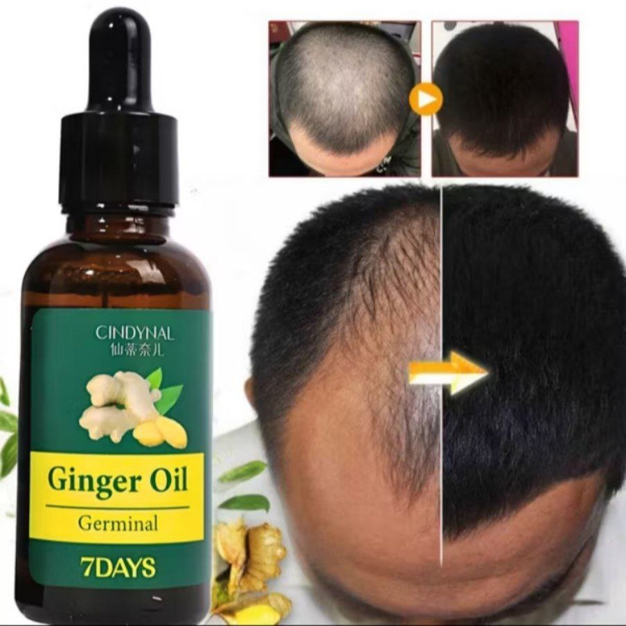 Jual Groove Hair Growth Serum / Ginger Germinal Oil Penumbuh Rambut ...