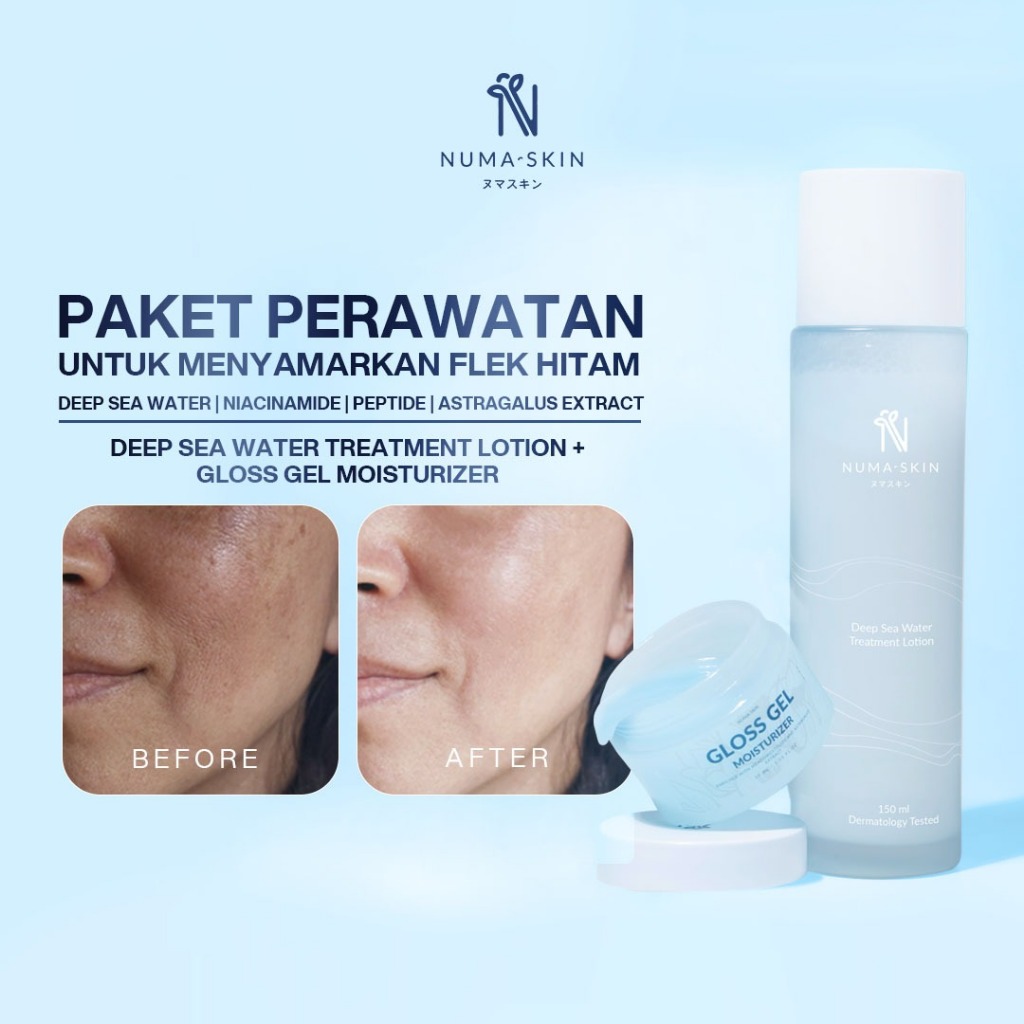 Jual Numa Skin Hydrating Toner Pencerah Muka Dan Wajah 150ml + Skin ...