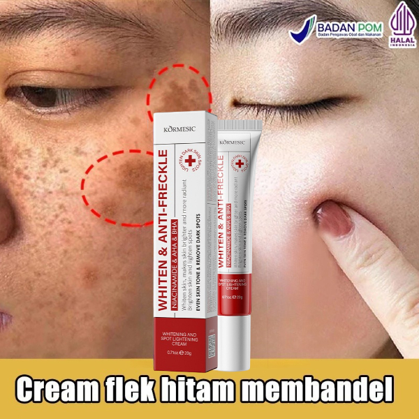 Jual 【BPOM】Krim penghilang flek hitam Krim pemutih wajah Salep flek ...