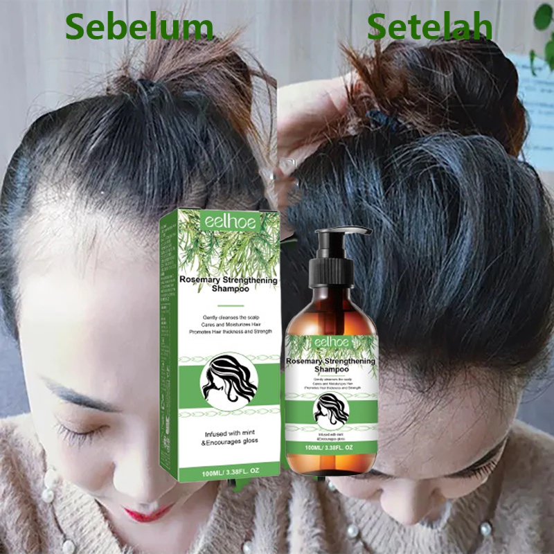 Jual Rosemary Shampoo Pemanjang Rambut Cepat Shampoo Penumbuh Rambut Cepat Shampoo Rambut Rontok ...