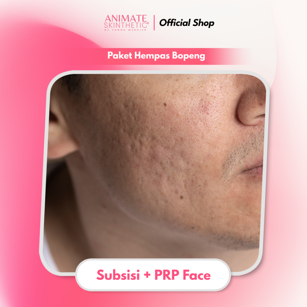 Jual September Ceria - Animate Subsisi + PRP Face | Shopee Indonesia