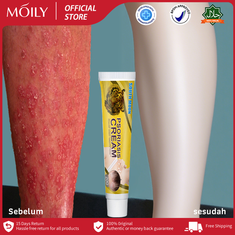 Jual salep eksim salep gatal china salep kurap ekstrak herbal alami ...