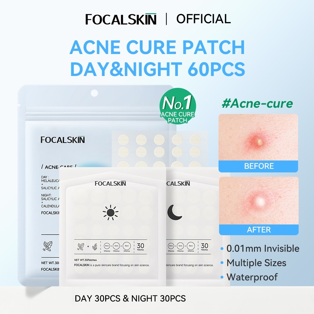 Jual FOCALSKIN Acne Cure Patch Pimple Patch Acne Spot / Sticker Jerawat ...