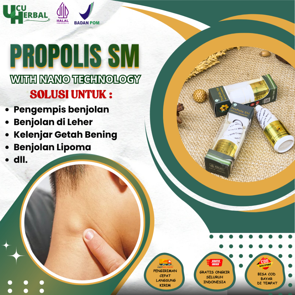 Jual PROPOLIS SM - Obat Benjolan Di Leher Kiri, Kanan, Belakang, Depan ...