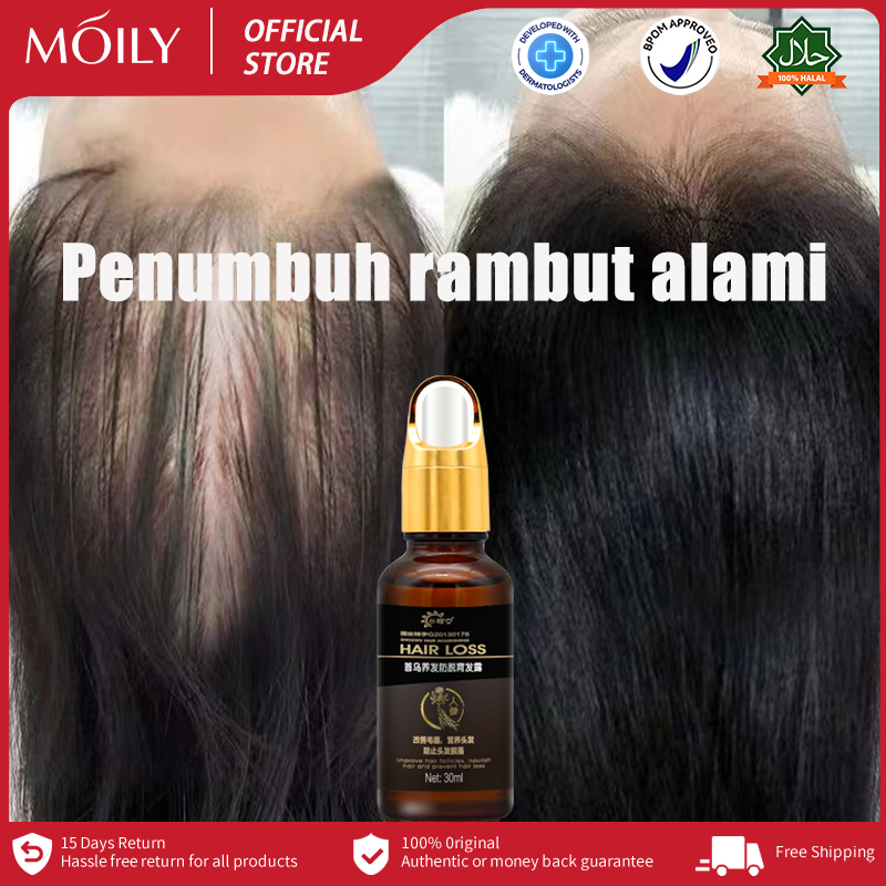 Jual serum penumbuh rambut hair serum penumbuh rambut obat penumbuh ...
