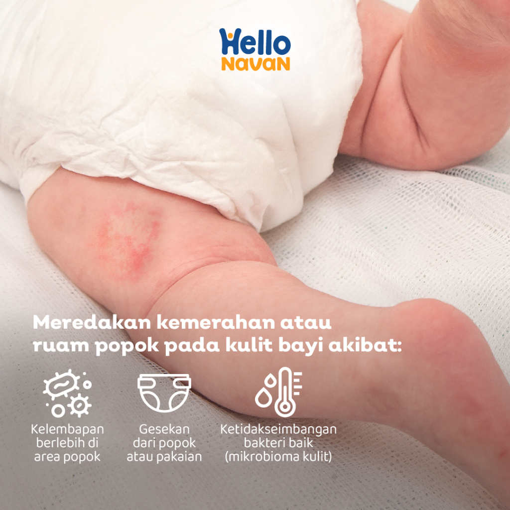 Jual [GIMMICK SAMPLE TIDAK UNTUK DIJUAL] Hello Navan Bumbum Baby Diaper ...