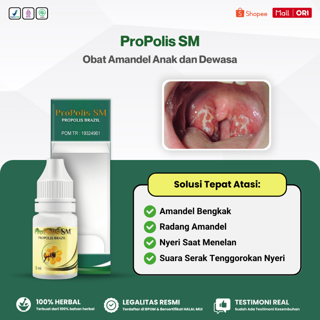 Jual Obat Amandel Anak & Dewasa, Pengempes Amandel Bengkak, Radang Amandel, Nyeri Menelan ...