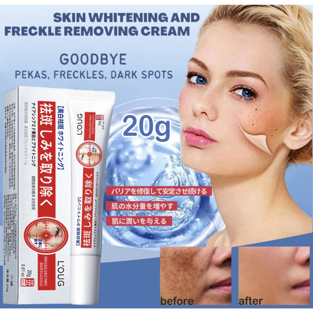 Jual Whitening Freckle Cream Remove Dark Spots Anti Freckle Cream Niacinamide Fade Pigmentation ...
