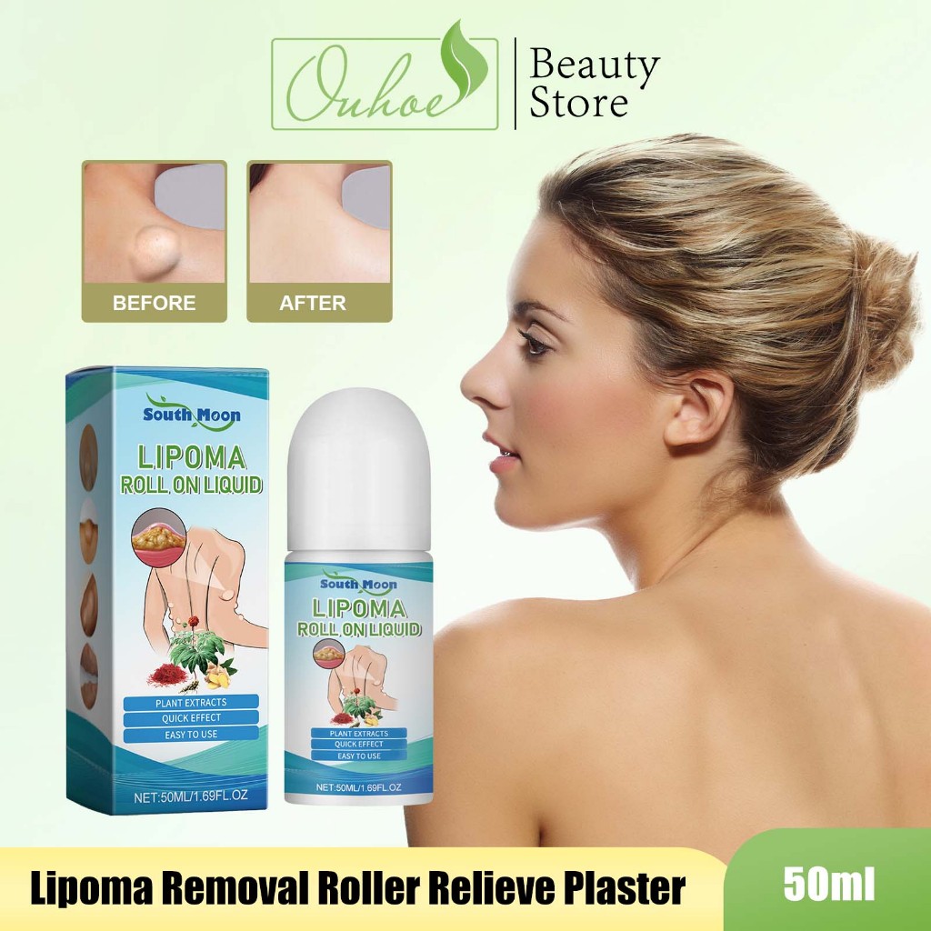 Jual South Moon Lipoma Removal Roller Relieve Plaster 50ml - Lipoma ...