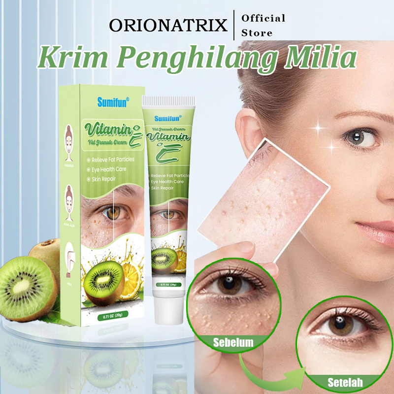 Jual Orionatrix Krim Penghilang Milia Di Wajah Salep Milia Di Bawah ...