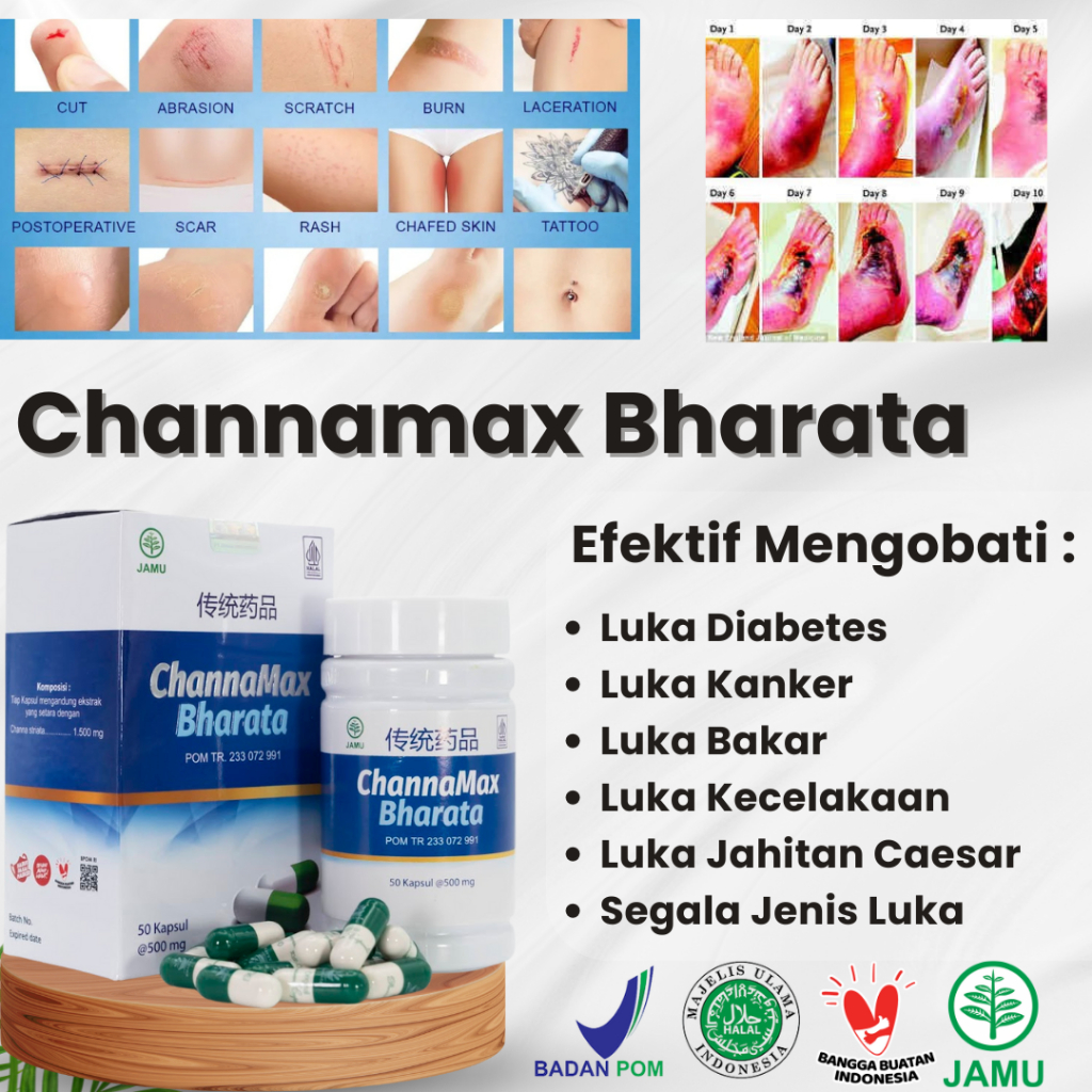 Jual Obat Luka Caesar - Obat Luka Diabetes - Obat Luka Luar dan Dalam ...