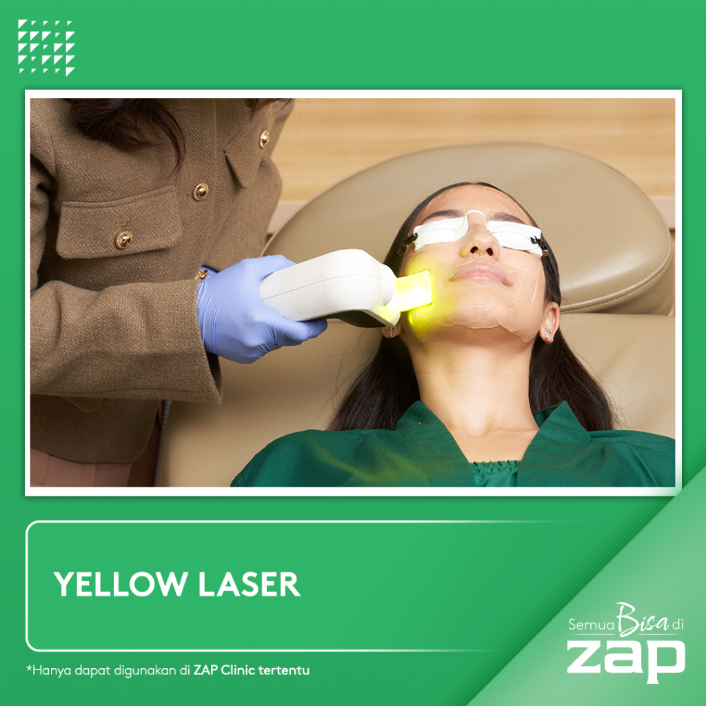 Jual Pro Yellow Laser ZAP | Shopee Indonesia