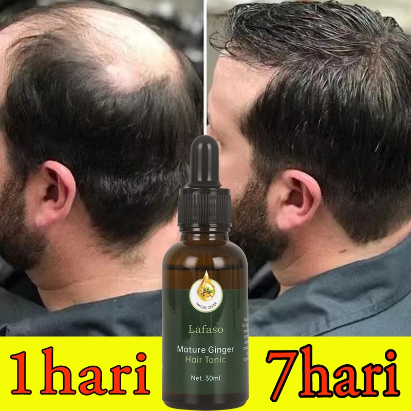 Jual obat ampuh untuk rambut perontok parah-penumbuh rambut secara ...