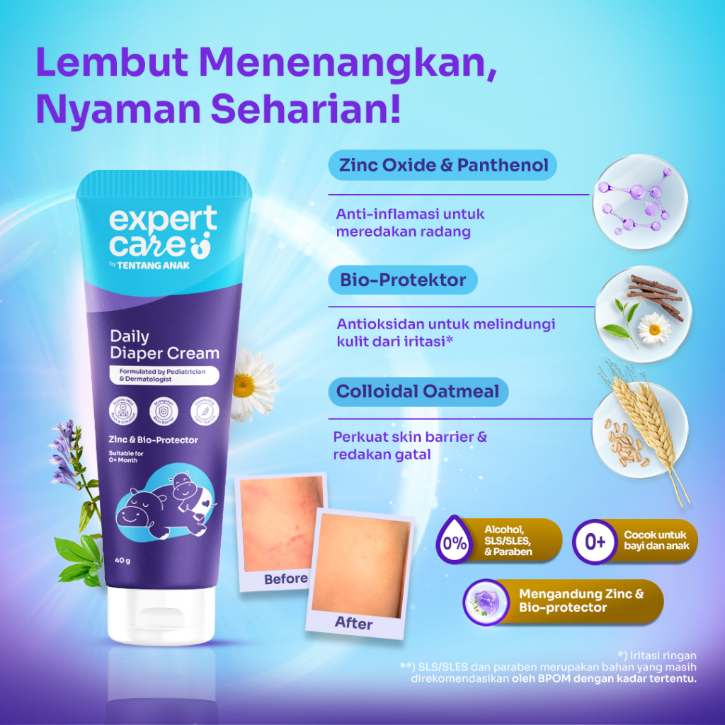 Jual Expert Care - Paket Bundling Diaper Rash Cream 40g + Face & Body ...