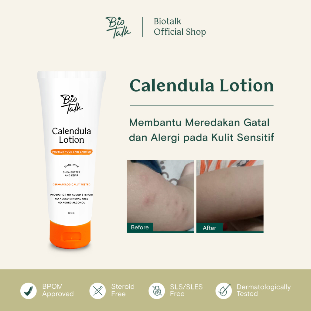 Jual Biotalk Calendula Lotion | No Steroid | Membantu Menjaga ...