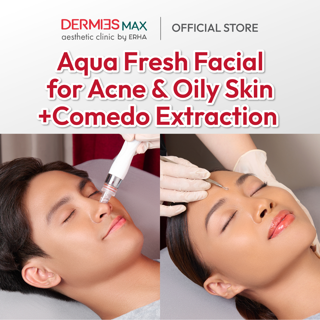 Jual Dermies Max Aqua Fresh Facial for Acne & Oily Skin + Comedo ...