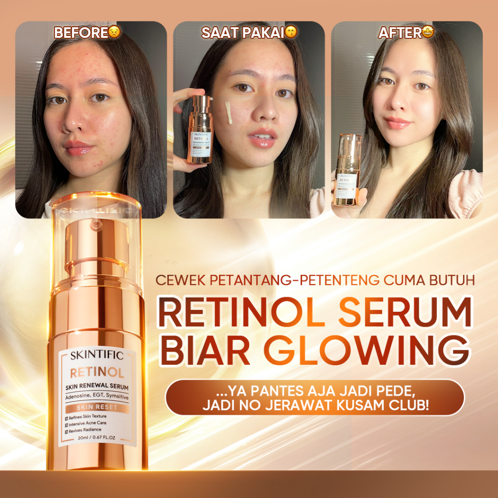 Jual [SKINTIFIC AUTHORIZED] Retinol Skin Renewal Serum 20ml | Retinoid Memudarkan Garis Halus ...