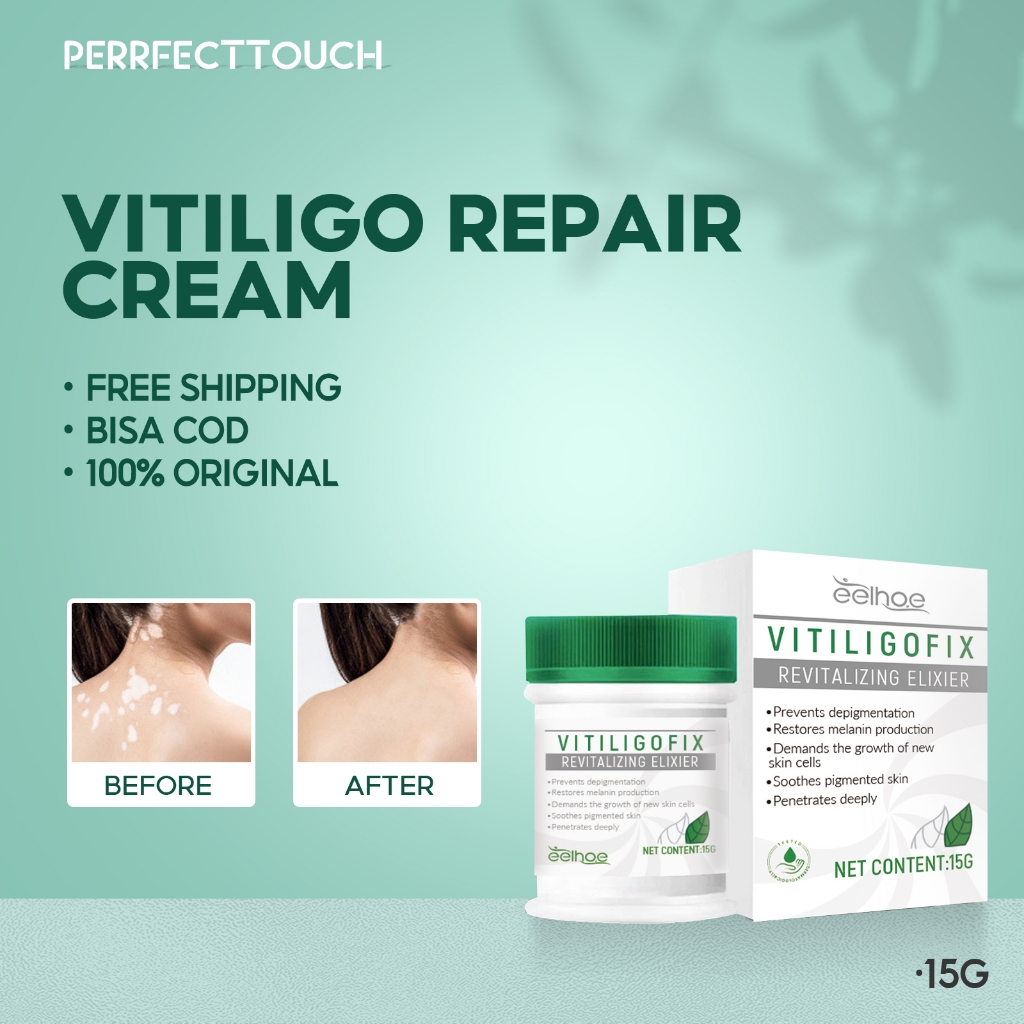 Jual EELHOE/100%ORI/COD/ Vitiligo Repair Cream 15g Krim Perbaikan ...