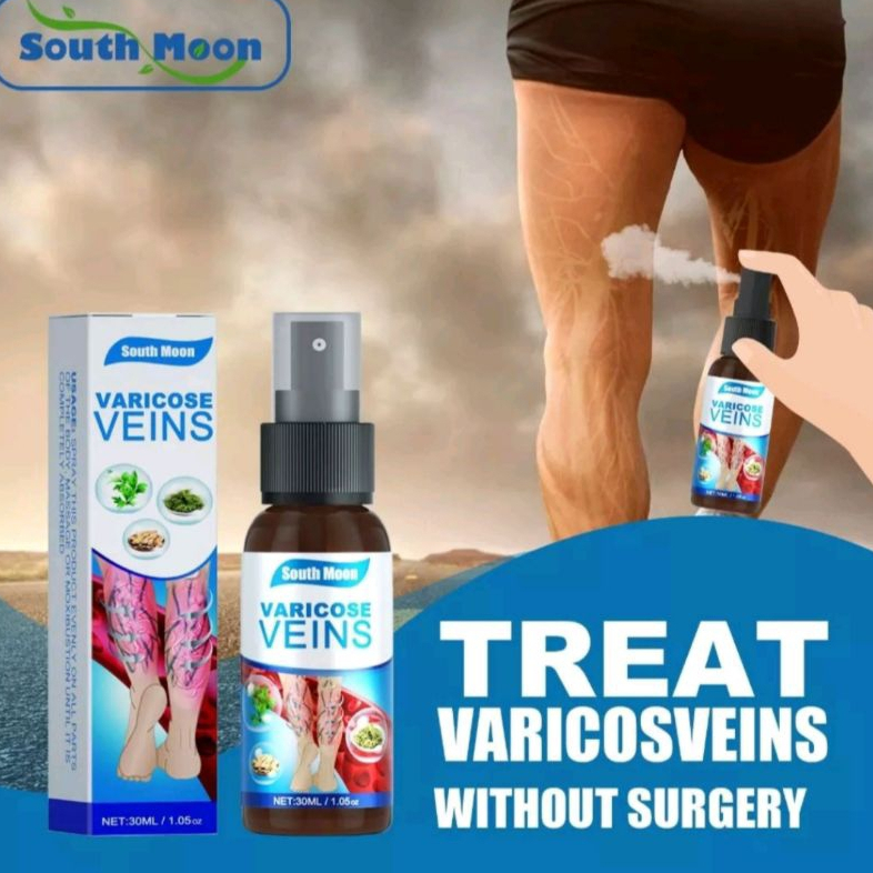 Jual Varicose Veins Obat Varises Spray Penghilang Varises Greenery ...