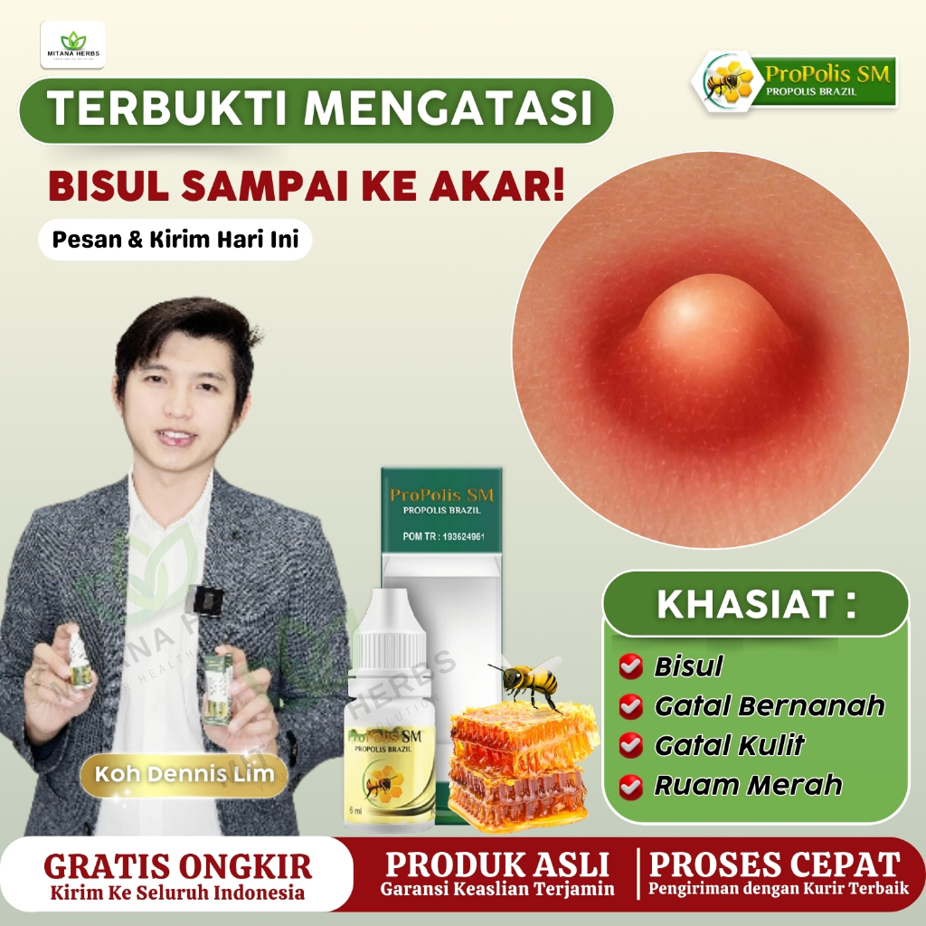 Jual Obat Bisul, Bisul Di Pantat Bayi Anak Dan Dewasa Bisulan Bisul ...