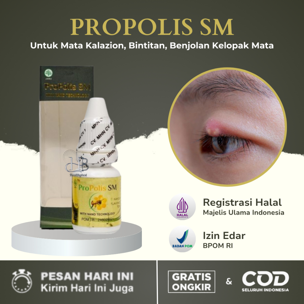 Jual {TERLARIS!!!} Obat Oles Kalazion, Obat Mata Kalazion Pada Anak Dan ...