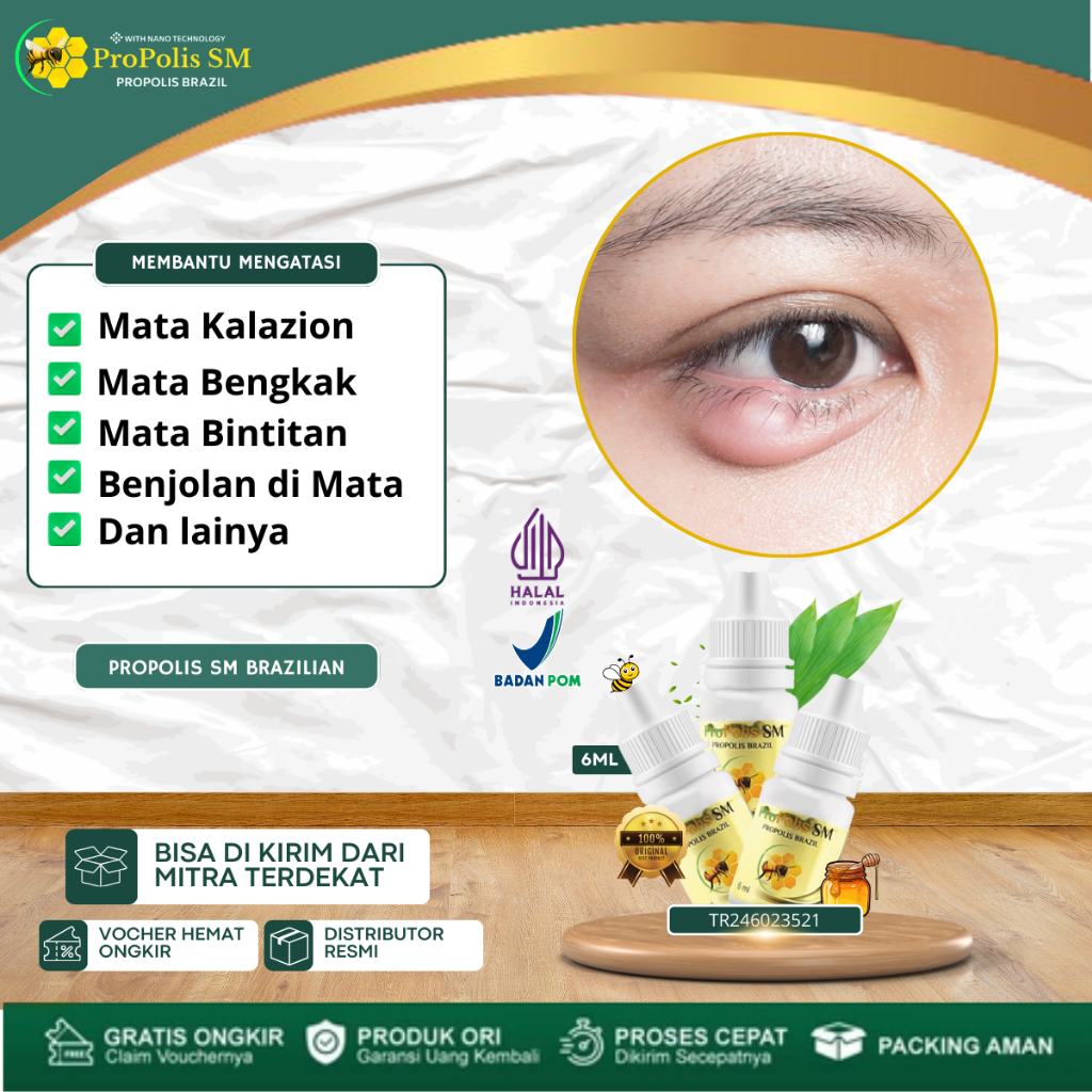 Jual Obat Mata Kalazion, Timbilan Mata Bintitan di Kelopak Mata ...