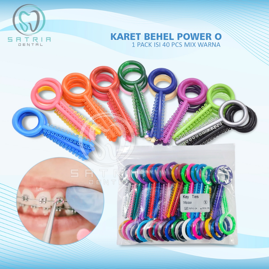 Jual Karet Behel Orthodontic Tebal Power O Karet Behel Braces Ring ...