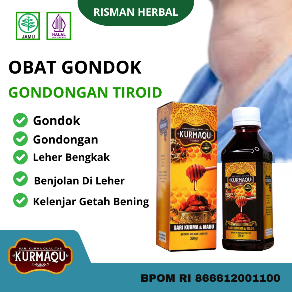 Jual Madu Obat Gondok Gondongan Tiroid Sakit Saat Menelan, Benjolan ...