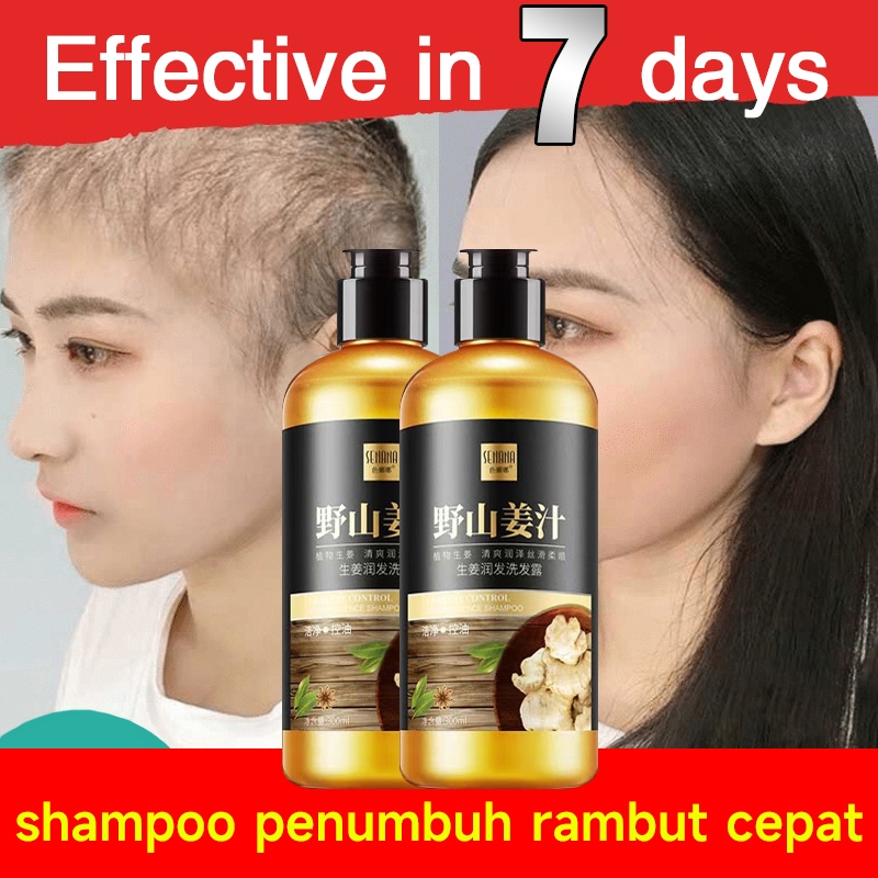 Jual Ginger Shampo 300ml Shampo Jahe Penumbuh Rambut Tebal Anti Ketombe Gatal Anti Rambut Rontok ...