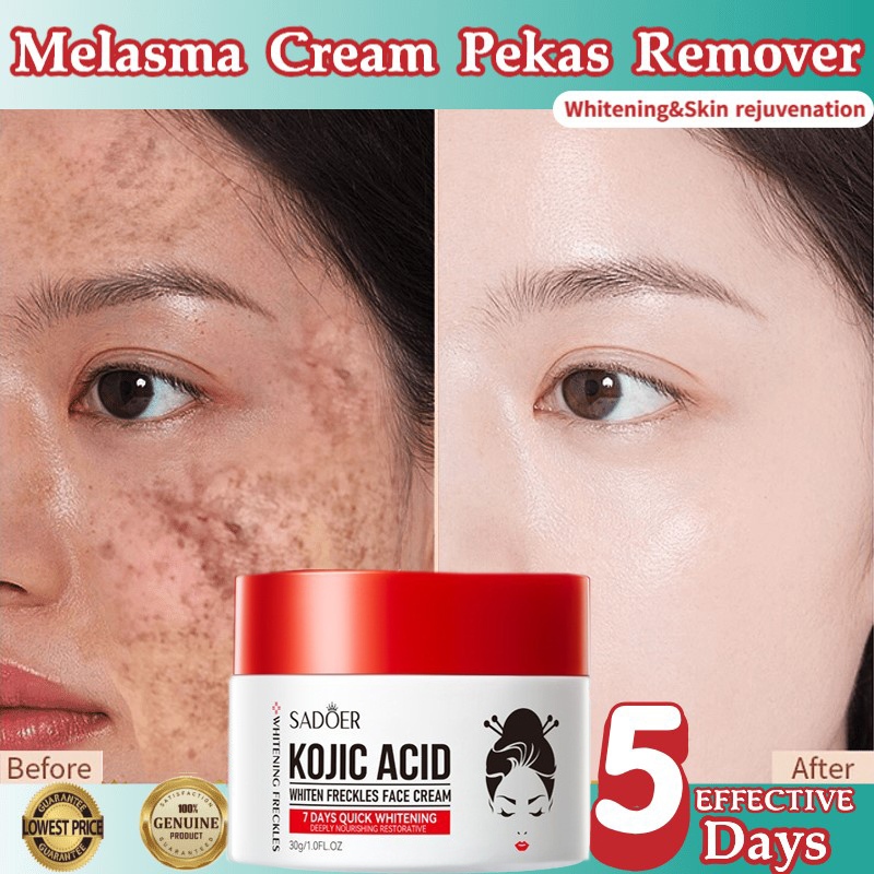 Jual Cream penghilang flek hitam whitening Krim anti bintik dan pemutih ...