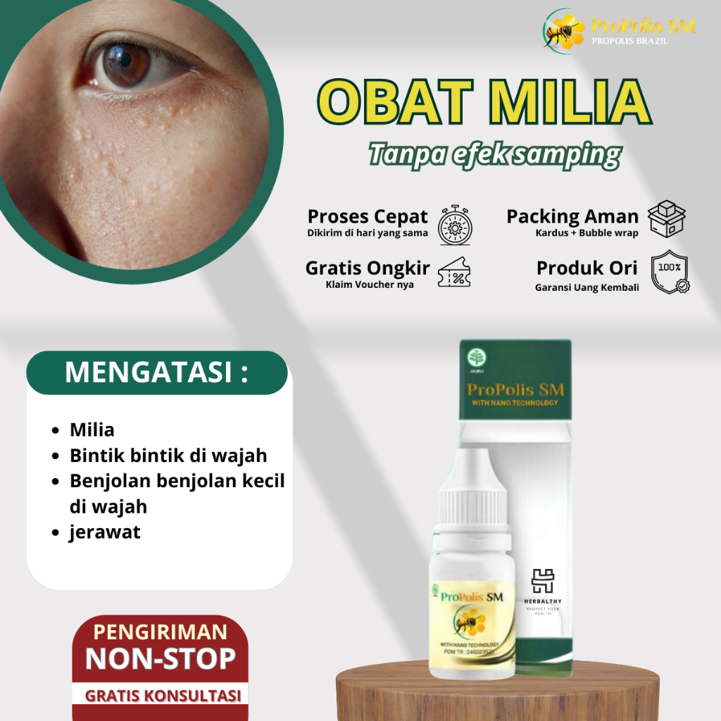 Jual ProPolis SM Obat Milia Di Bawah Kelopak Mata, Obat Bintik Putih ...