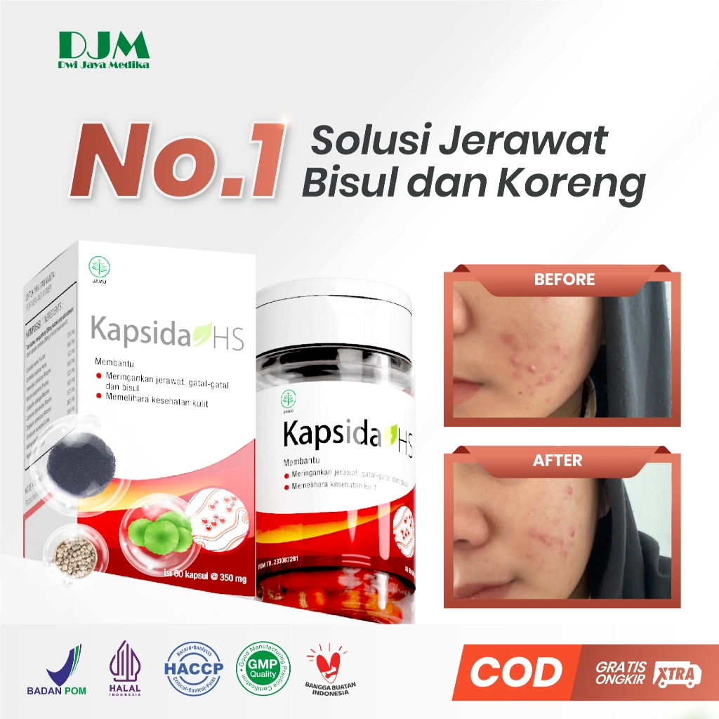 Jual KAPSIDA HS 60 Kapsul Botol - Obat Jerawat, Gatal Alergi, Bisul ...