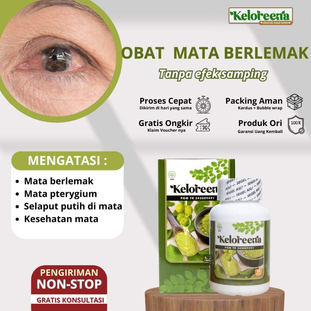 Jual Obat Mata Berlemak Ptregium Kekuningan Vitamin Untuk Mata Obat Selaput di Bagian Putih Bola ...