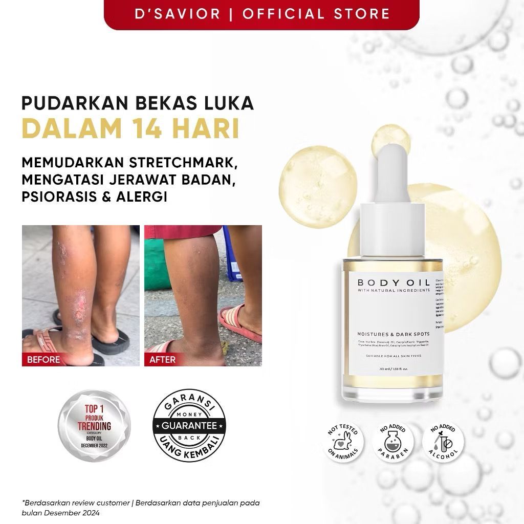 Jual Dsavior Body Oil 30ml Penghilang Bekas Luka Eksim Psioriasis ...