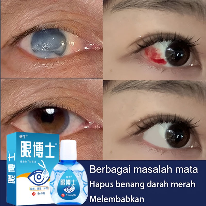 Jual Obat tetes mata Tetes Mata eye drop Obat mata obat mata katarak ...