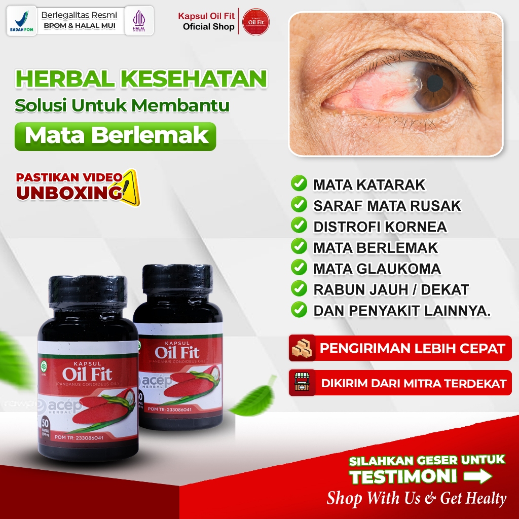 Jual Kapsul Oil Fit Obat Mata Berlemak Kekuningan Penyakit Pterigium Glaukoma Katarak Ada ...