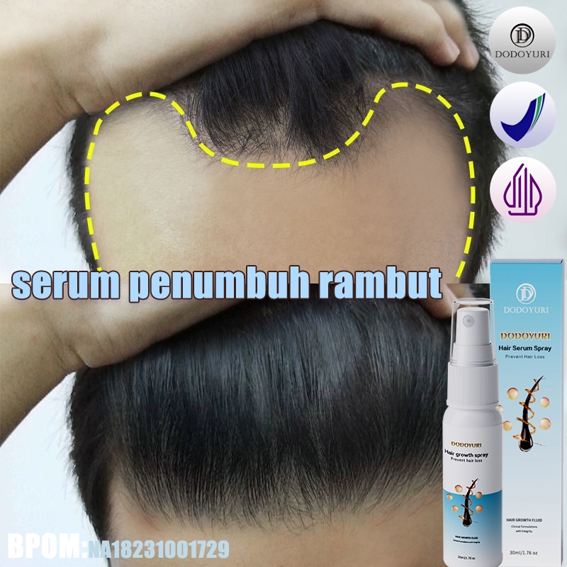 Jual [BPOM] Penumbuh rambut cepat obat penumbuh rambut serum penumbuh ...