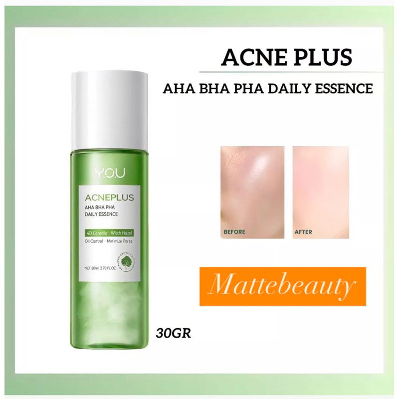 Jual YOU ACNE PLUS AHA BHA PHA DAILY ESSENCE | Shopee Indonesia