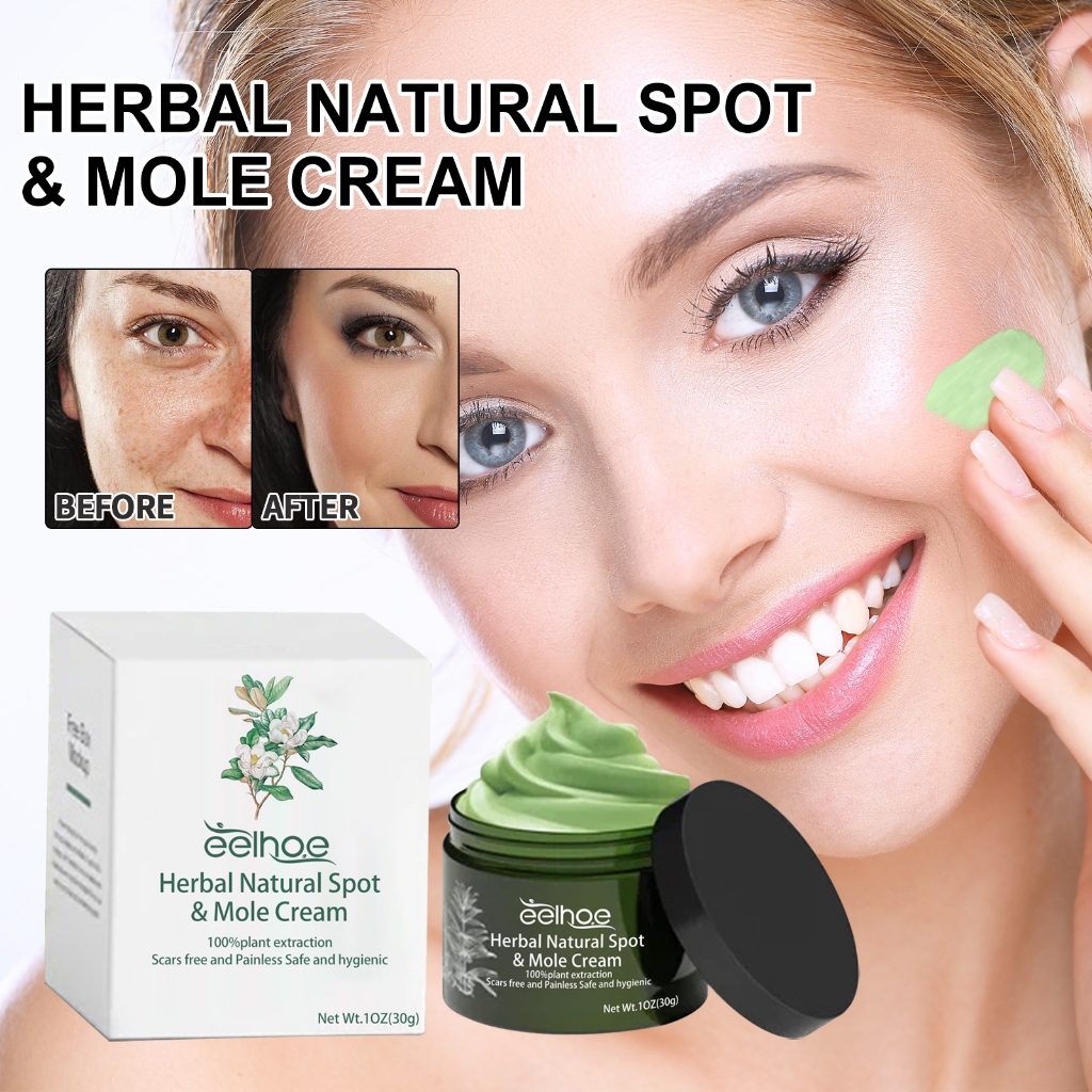 Jual EELHOE Herbal Natural Spot Mole Cream 30g Plant Extractionscars ...