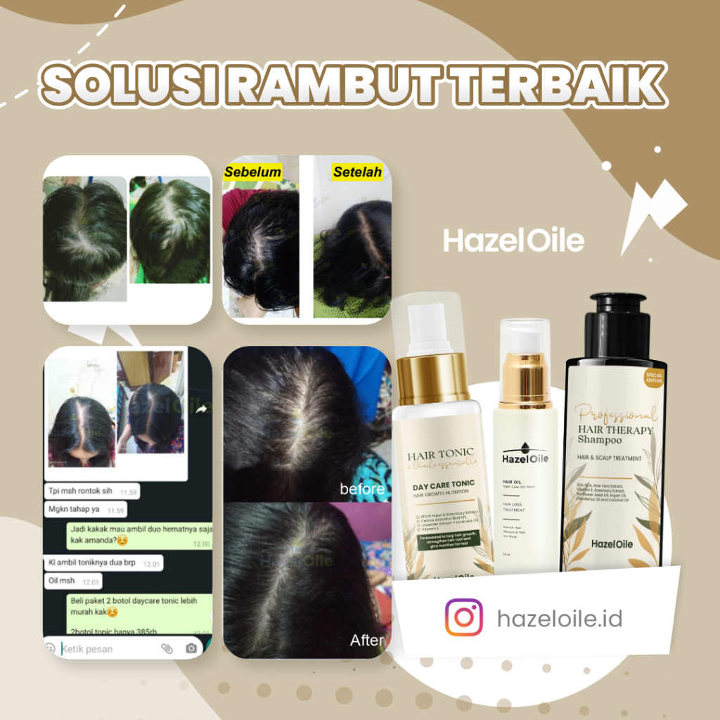 Jual [BPOM] HazelOile Rambut Rontok Treatment Hair Tonic Tonik Penumbuh ...