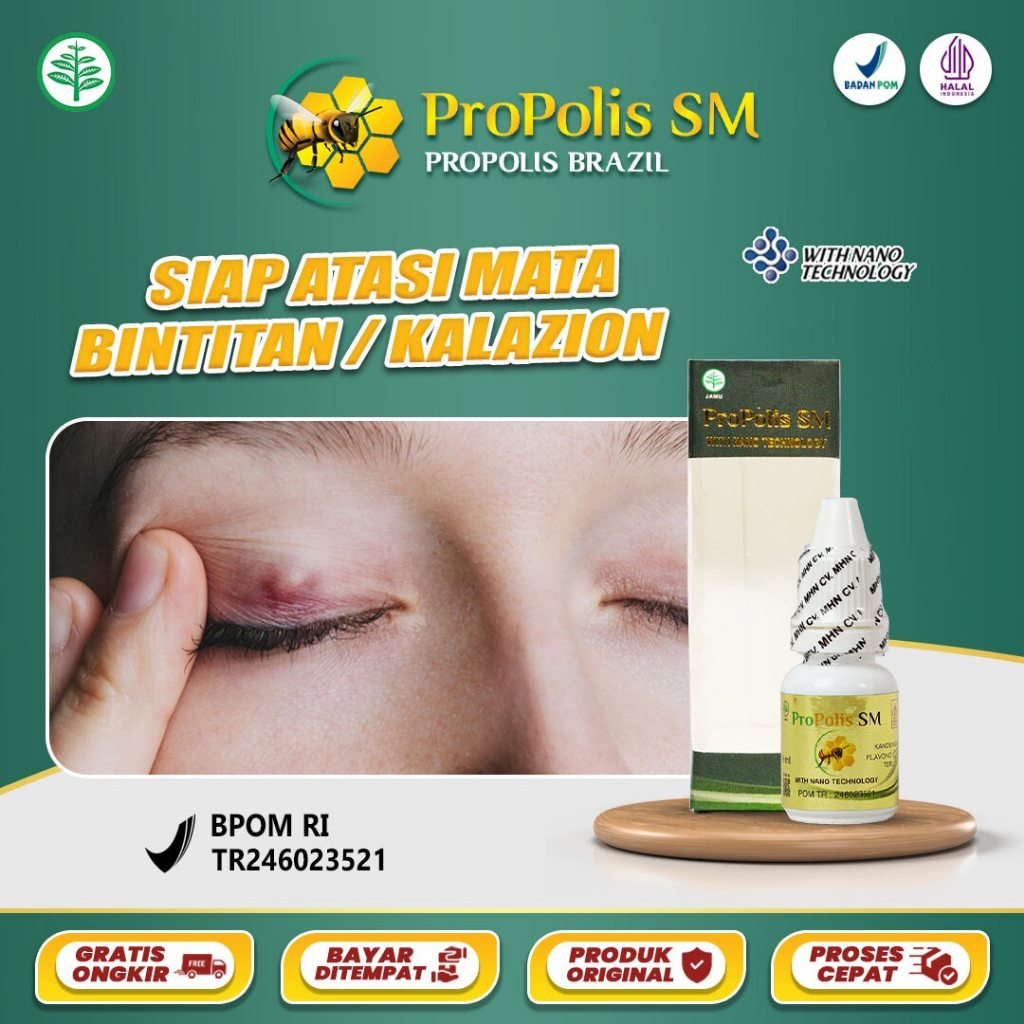 Jual Obat Mata Bintitan, Kalazion Untuk Anak Dan Dewasa, Benjolan Di ...
