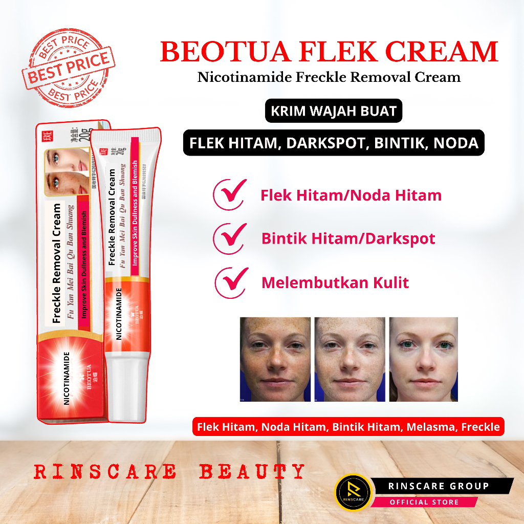 Jual [ FLEK CREAM BEOTUA ] Beotua Nicotinamide Freckle Cream 20gr Bintik Hitam, Noda Hitam ...