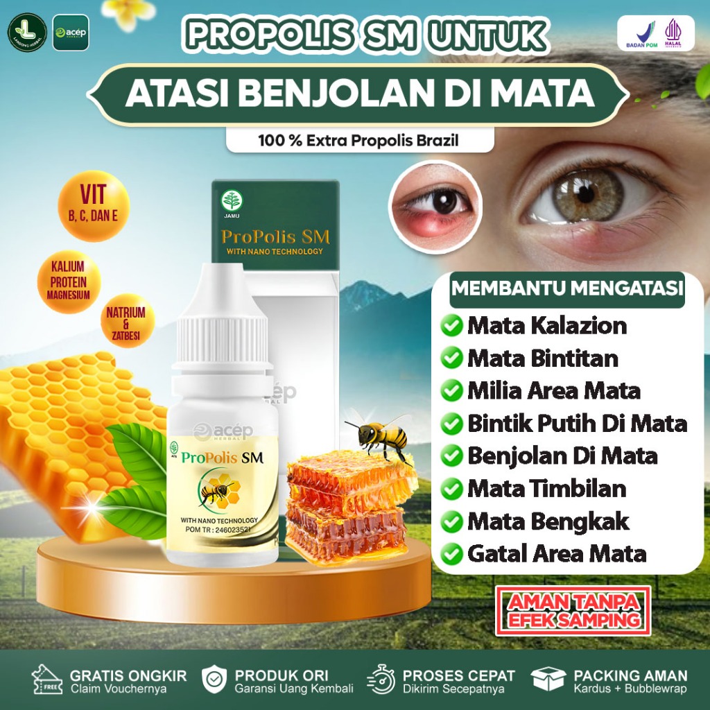 Jual Obat Mata Kalazion Benjolan Di Mata Bagian Luar Salep Mata ...
