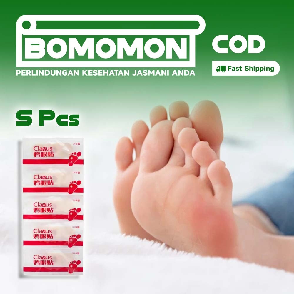 Jual Plester Obat Kutil Mata Ikan Foot Corn Removal Plester Plaster ...