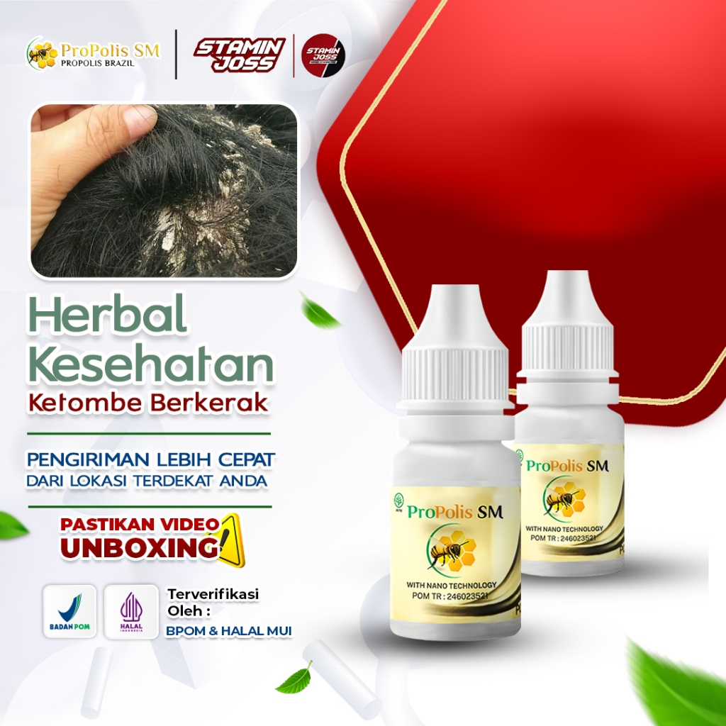 Jual Obat Anti Ketombe Penghilang Ketombe Berkerak Dan Gatal Kulit kepala Gatal Gatal Jamur ...