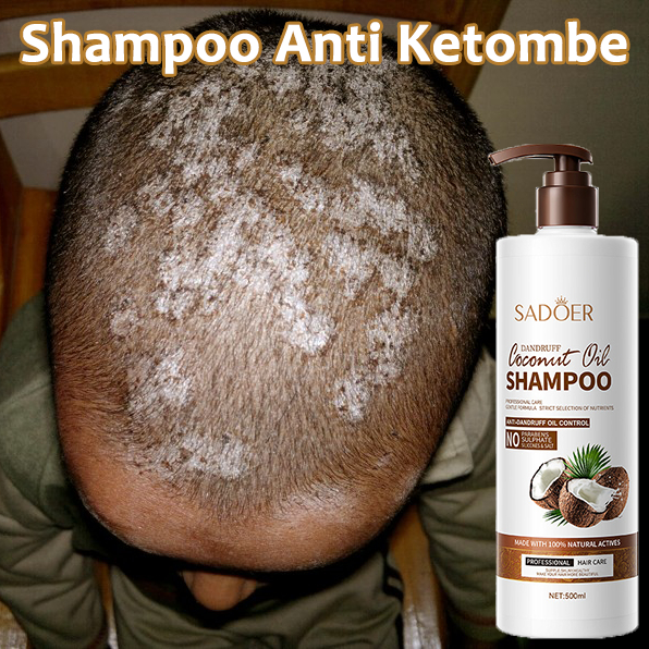Jual Shampo Anti Ketombe Obat Ketombe Shampoo Rambut Rontok Penghilang Ketombe Shampo Kutu ...